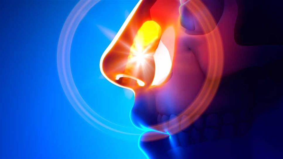 Conoce los tipos de rinitis | Luz Noticias
